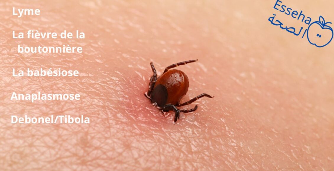 Les maladies et symptômes transmis par les tiques les plus courants ...
